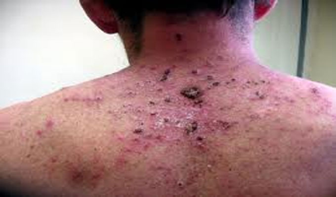 Tunisie - Bizerte: Réouverture du collège fermé à Mateur | Directinfo